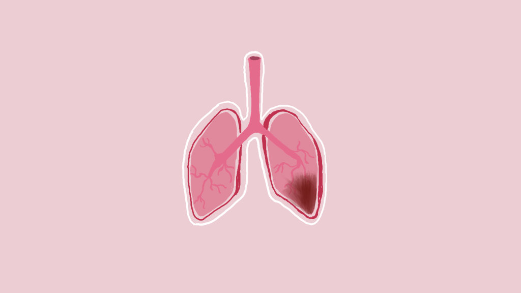 RPI Deficiency: Intricacies of Vitamins (Riboflavin) – pathoscribe